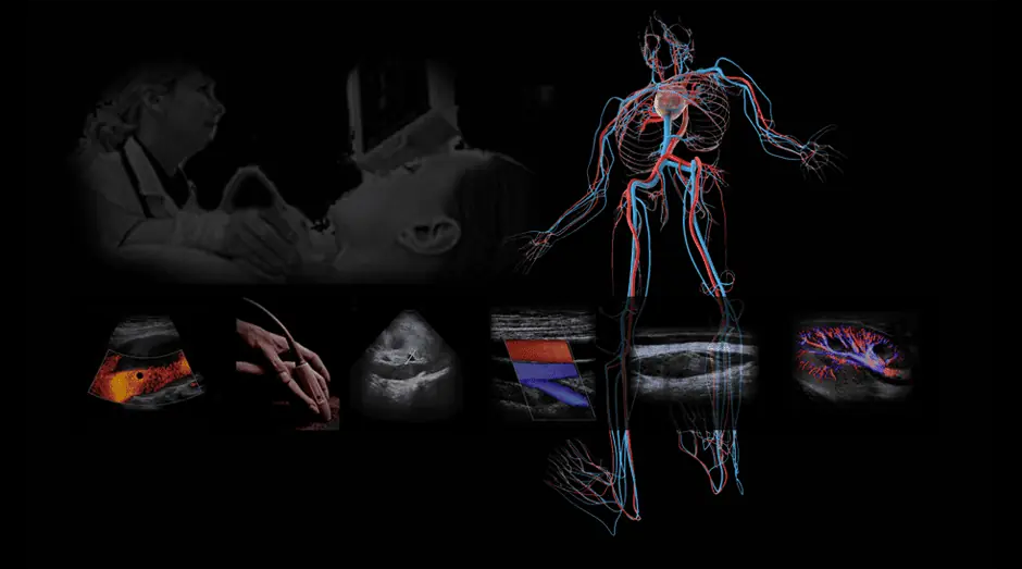 Vascular Ultrasound Course | POCUS Training | KMA Ultrasound