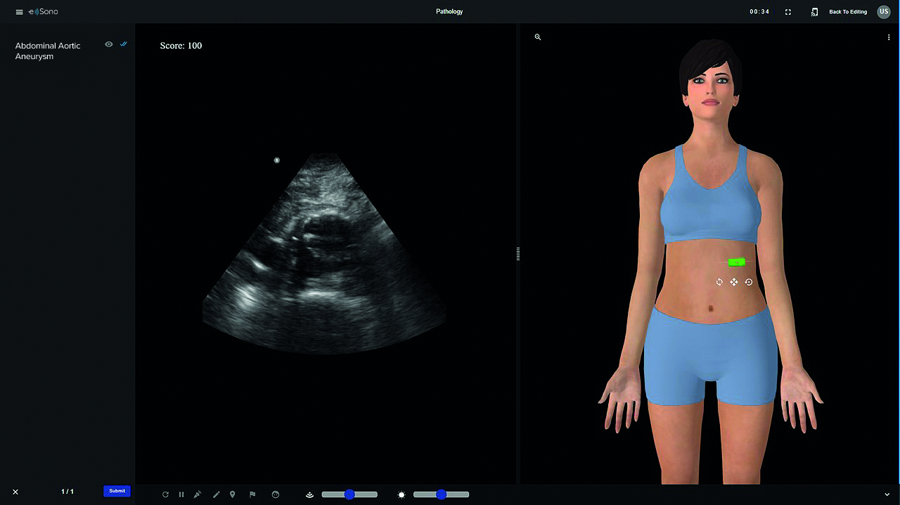 Top 8 Ultrasound Simulators: Novel Tools for POCUS Training
